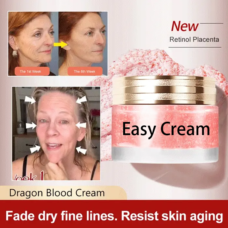 DRAGONS BLOOD EASY CREAM – PHAIVEIA